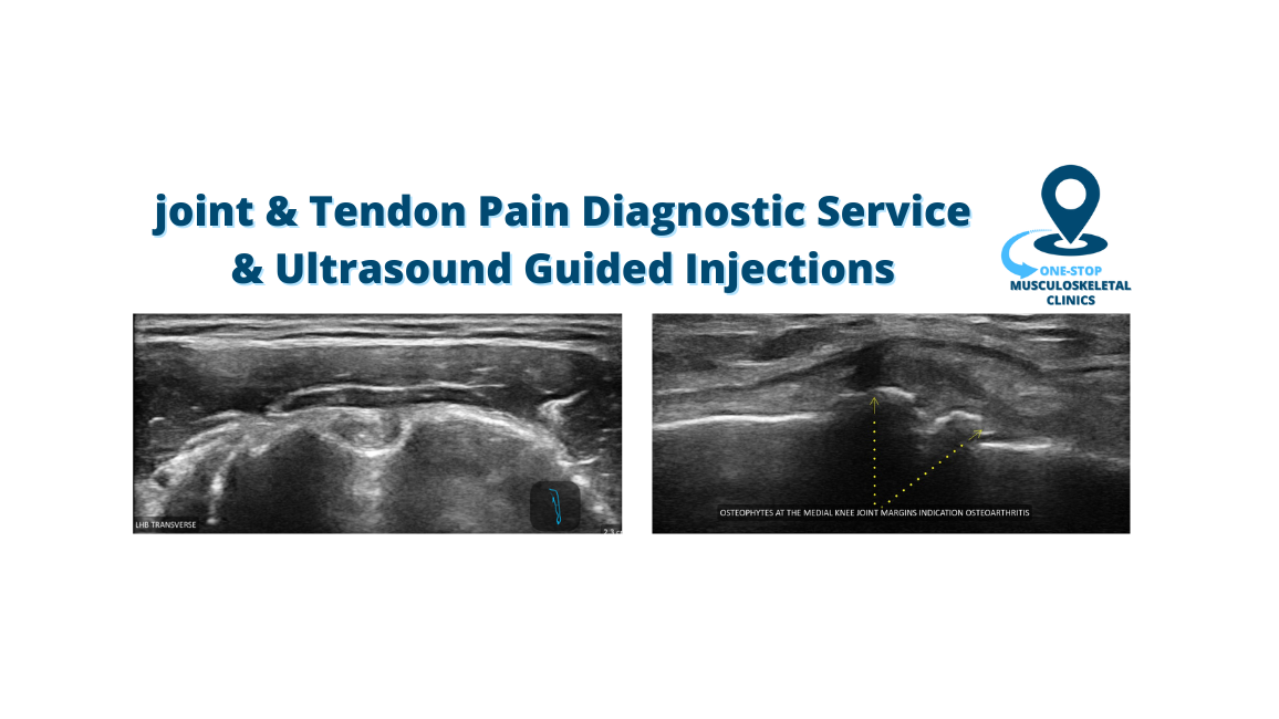 Joint & Tendon Pain Clinic | Diagnostic Ultrasound & Ultrasound Guided ...