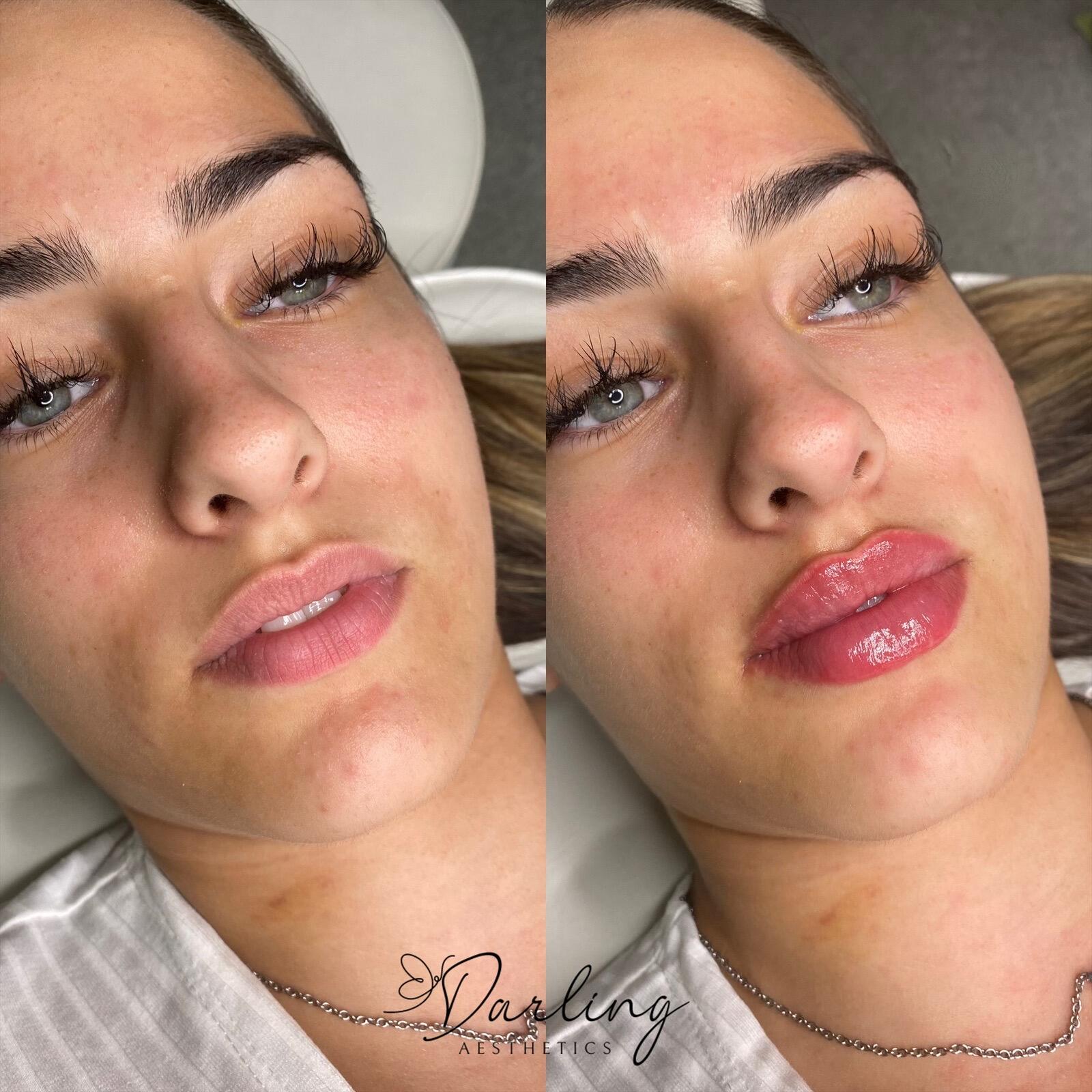 Darling Aesthetics - Windsor, GB-ENG - Nextdoor