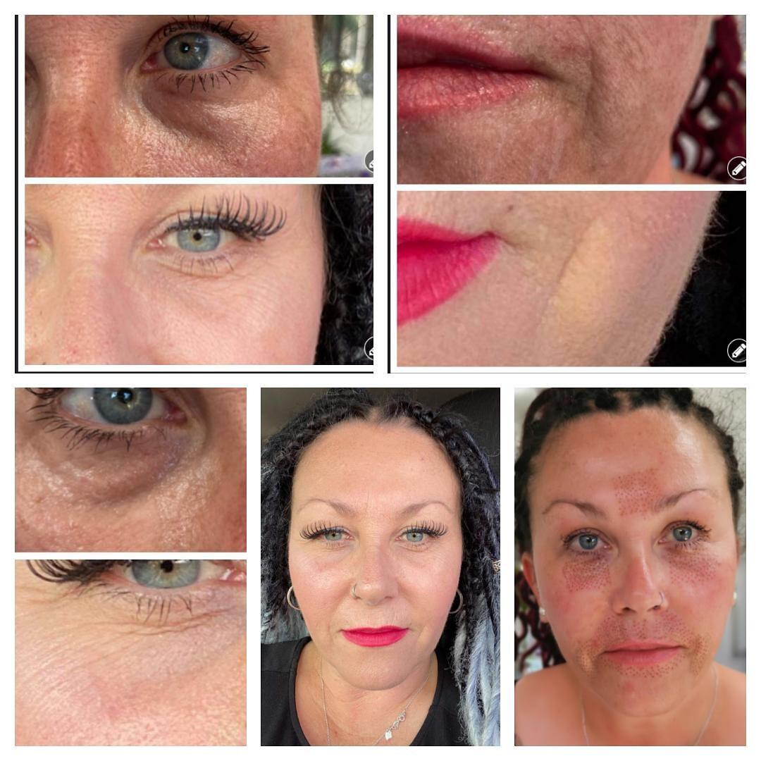 LGC_aesthetic - Basildon - Nextdoor