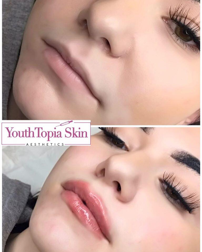 YouthTopia Skin Aesthetics - Basildon - Nextdoor