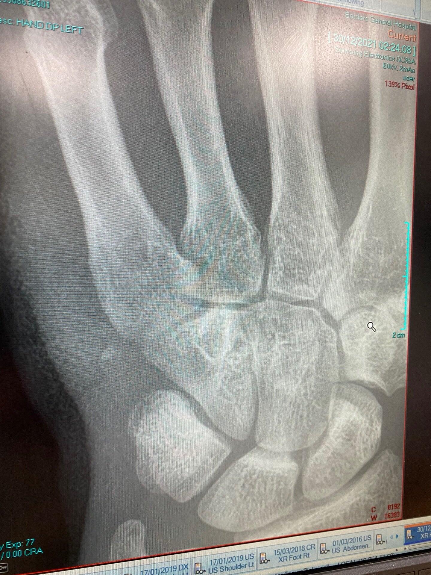 Borders General Hospital - Nextdoor