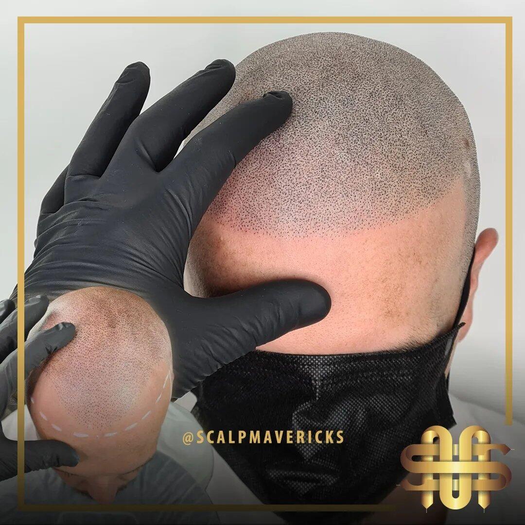 Scalp Mavericks - Rochester, Medway - Nextdoor