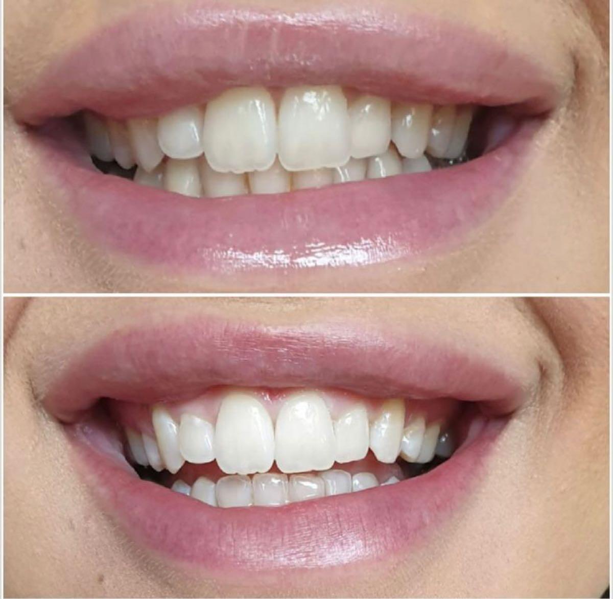 H&M Aesthetics - Jarrow, GB-ENG - Nextdoor