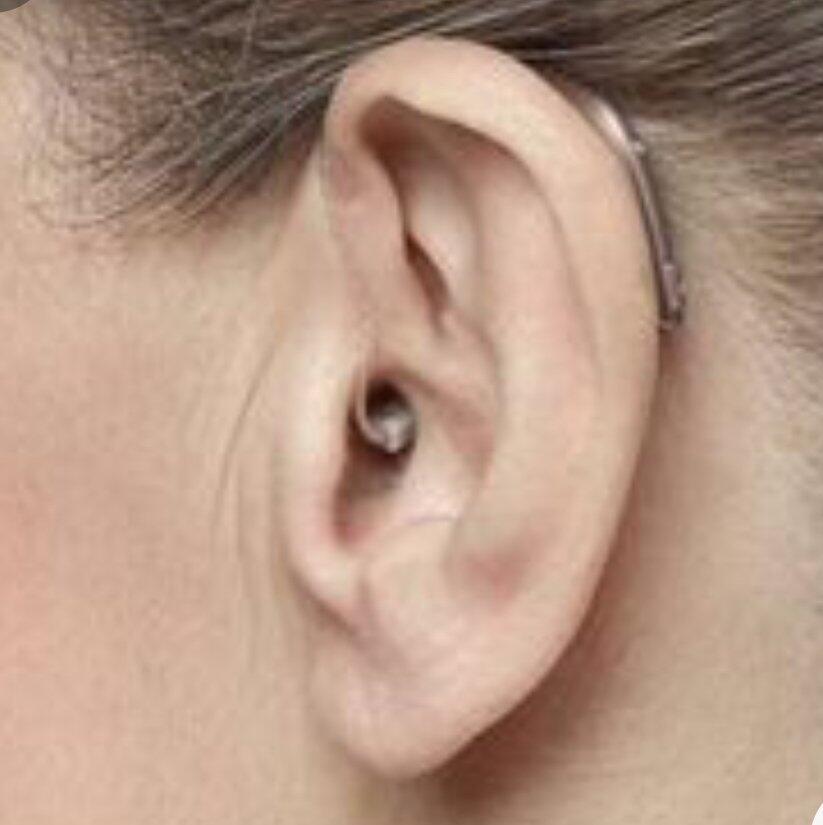 Crystal CL-EAR ear wax removal - Sheffield - Nextdoor