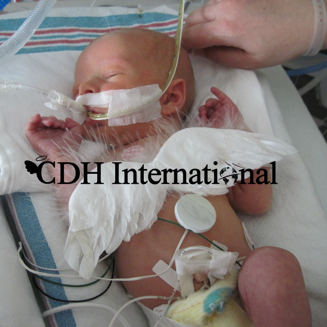 CDH International - Children's Medical Charity for Congenital ...