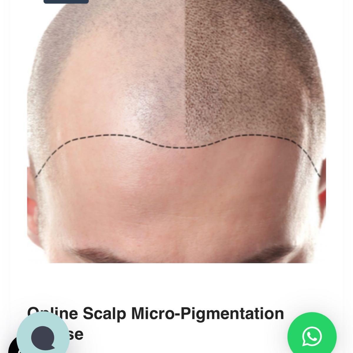 Scalp micropigmentation - London, GB-ENG - Nextdoor