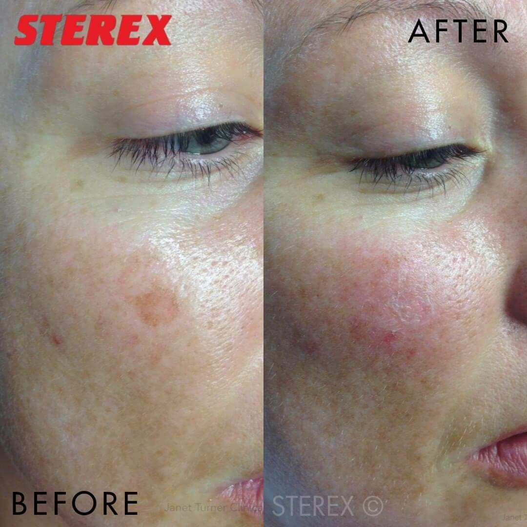 Vee Aesthetics - Cobham, England - Nextdoor