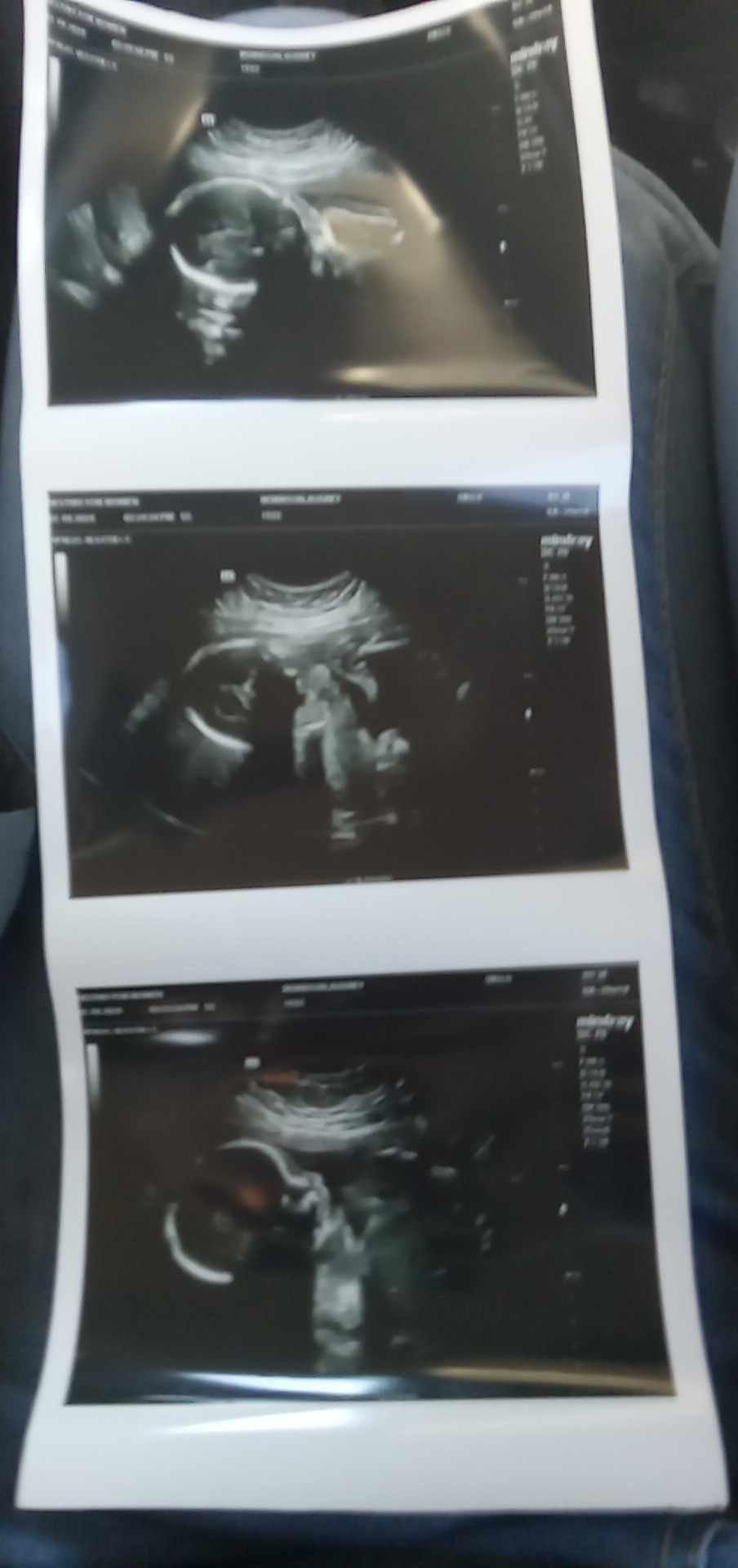 ISO Baby Items For Our Upcoming Baby for Free in Peoria, IL | For Sale ...