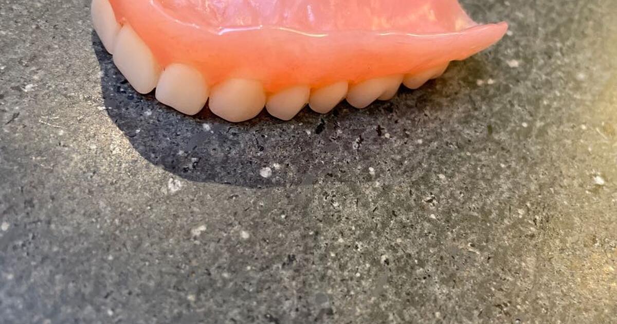 Upper Denture Set for Free in Denver, CO | For Sale & Free — Nextdoor