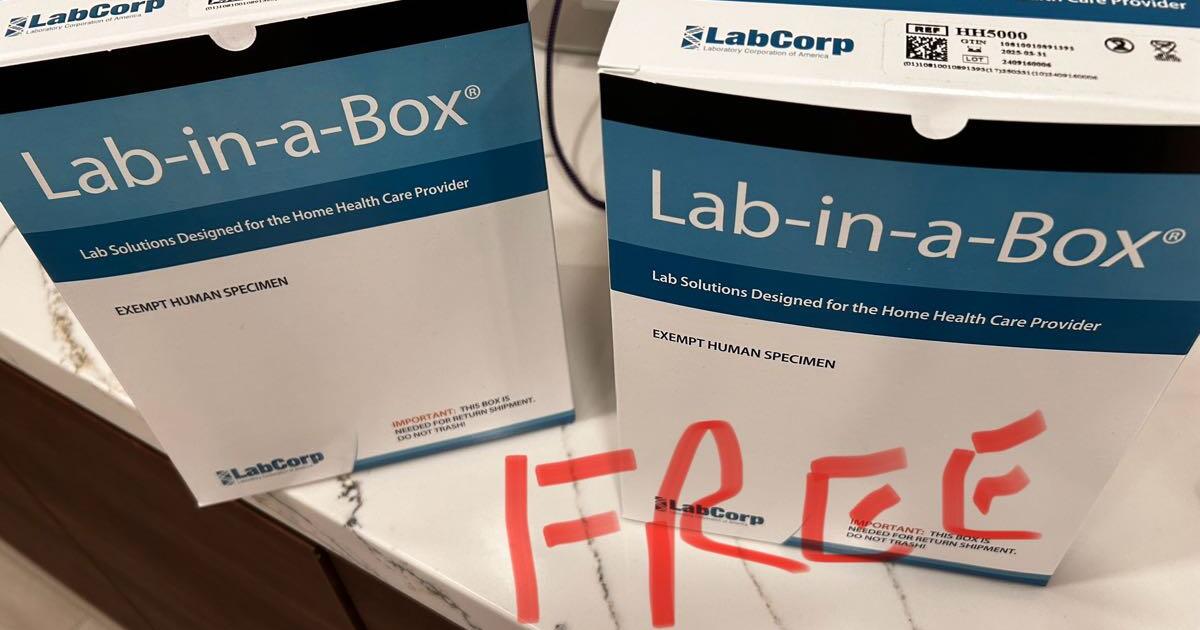 Free Lab in a Box Labcorp for Free in San Diego, CA | For Sale & Free ...