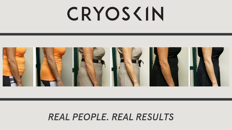 Christine Beauty Lounge, Llc · 30% off Cryoskin/CryoSlimming/CryoToning ...